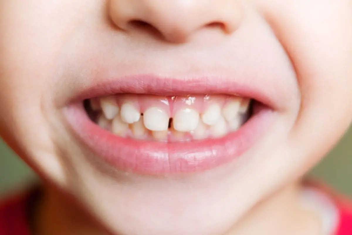 Four Types of Teeth and Their Functions | Fox Point Dental